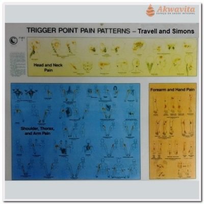 Mapa Trigger Point Pain Patterns Travell and Simons 2UN- Lj